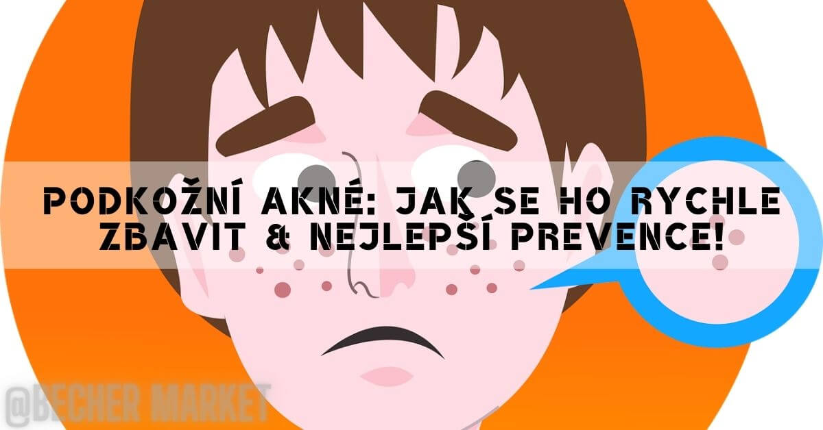 Podkožní Akné: Jak se ho Rychle Ubavit & Nejlepší Prevence! 2023