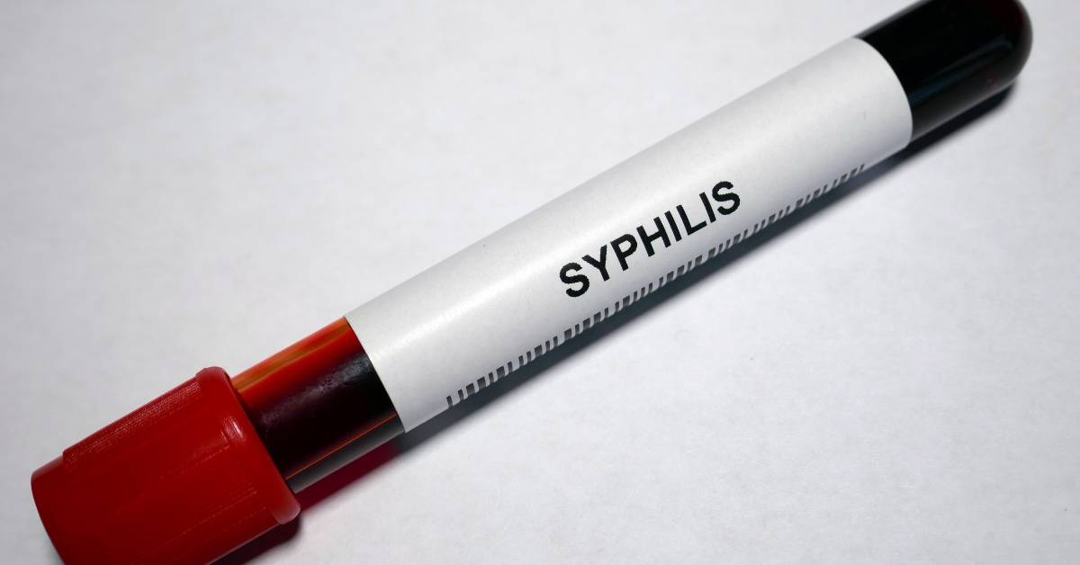 Jak Poznat Syfilis: Příznaky Mužů I žen, Testování A Léčba